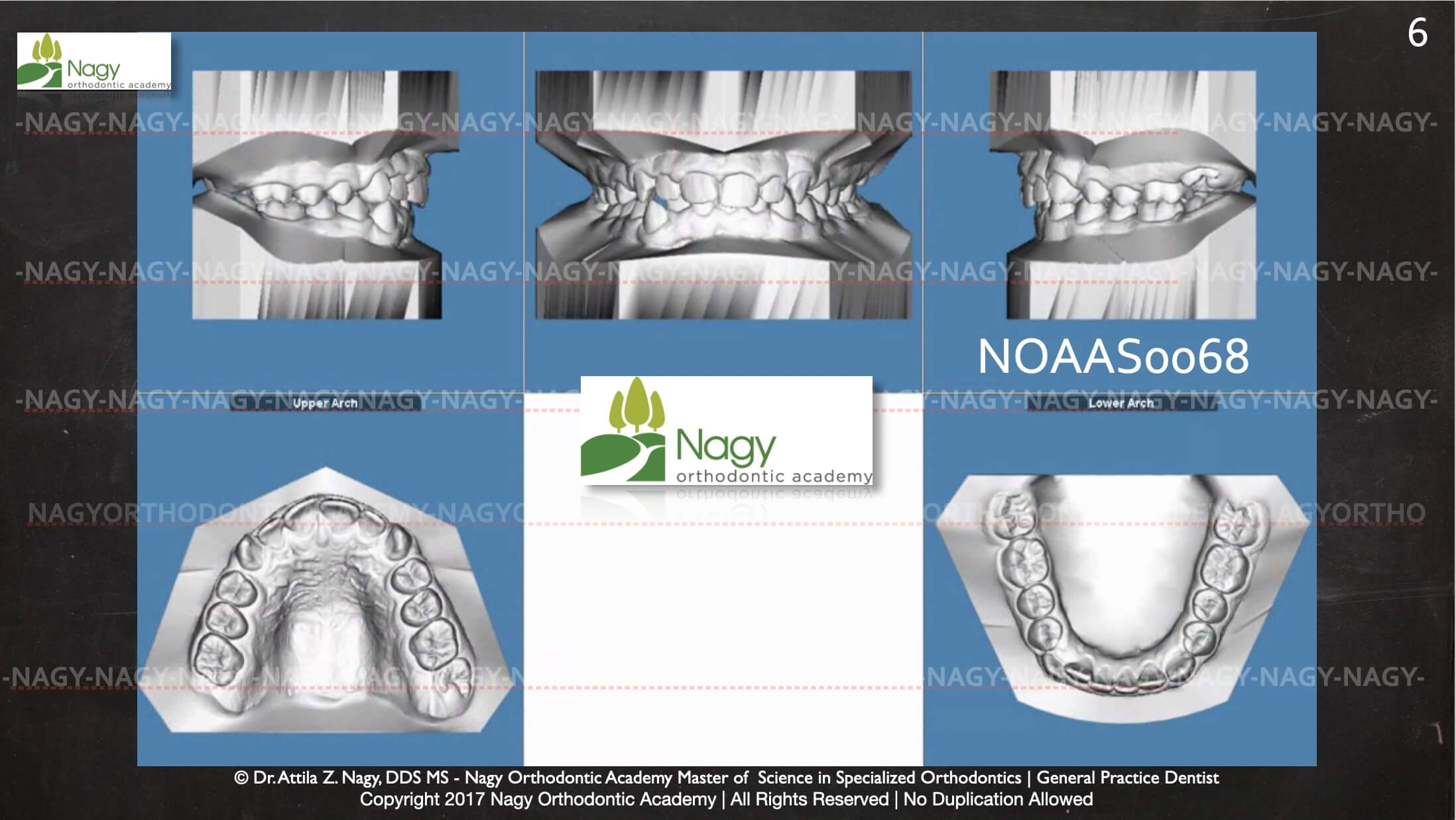 Arch model analysis using Dolphin software | ID#4033 – Nagy Orthodontic ...